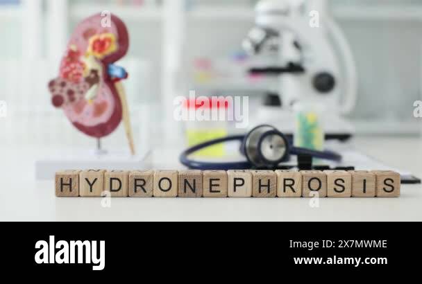 Word Hydronephrosis on clinic table near human kidney model at urine ...