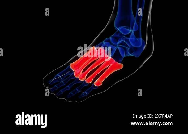 Metatarsal joint Stock Videos & Footage - HD and 4K Video Clips - Alamy