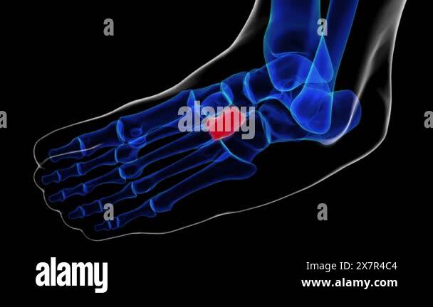 lateral view of cuneiform bone foot bones anatomy for medical Concept ...