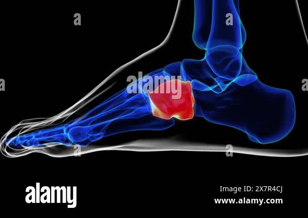 Lateral view of cuboid bone foot bones anatomy for medical Concept 3D ...