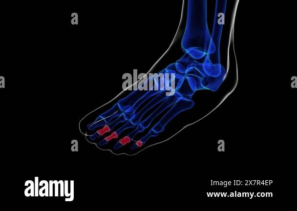 Middle cuneiform Stock Videos & Footage - HD and 4K Video Clips - Alamy