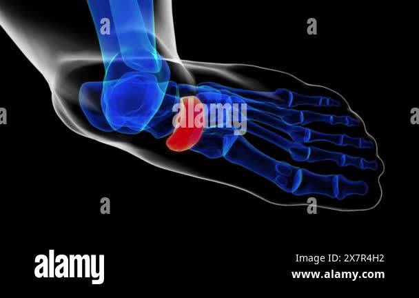 Dorsal view of foot bones navicular bone anatomy for medical Concept 3D ...