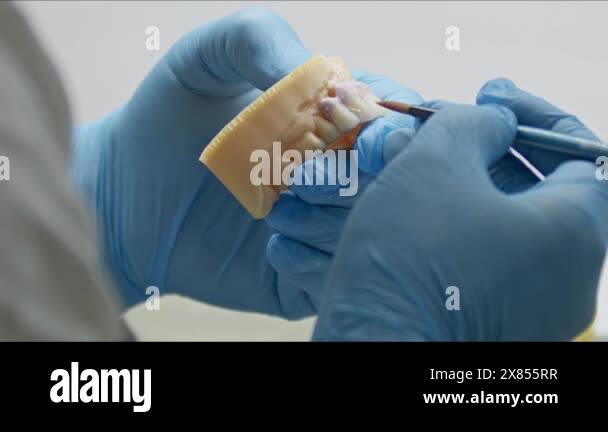 Painting Dentures According to Palate Color in the Prosthetic Dental ...