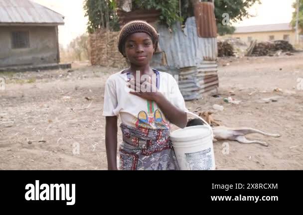 19 jan. 2024,Gwalada,Nigeria: Malnourished child due to extreme poverty, hunger, Rural Black ...