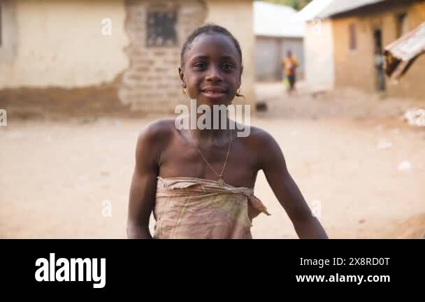 19 jan. 2024,Gwalada,Nigeria: Malnourished child due to extreme poverty, hunger, Rural Black ...