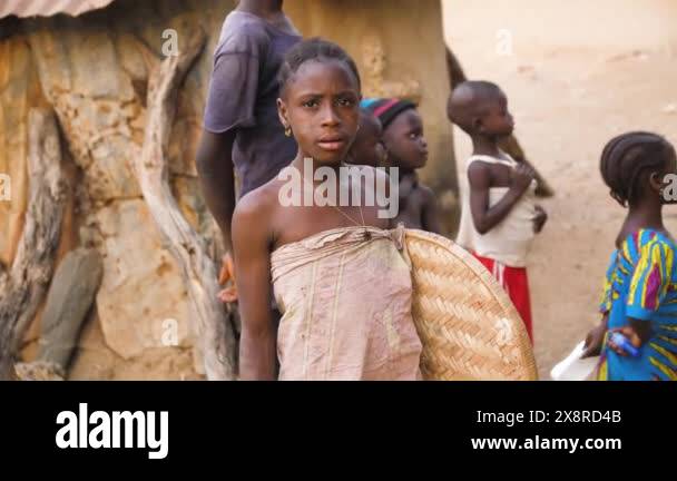 19 jan. 2024,Gwalada,Nigeria: Malnourished child due to extreme poverty, hunger, Rural Black ...
