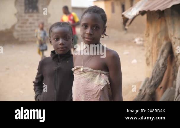 19 jan. 2024,Gwalada,Nigeria: Malnourished child due to extreme poverty, hunger, Rural Black ...