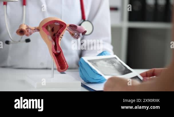Gynecologist consults woman with ultrasound scan of uterus ...