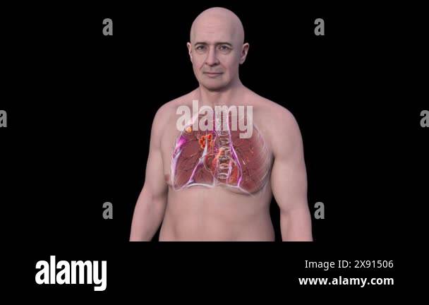 Bacterial nodules Stock Videos & Footage - HD and 4K Video Clips - Alamy