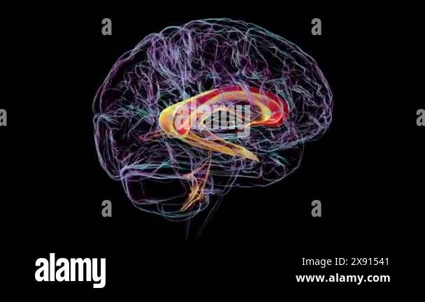 Animation showing a rotating human brain with corpus callosum and ventricles highlighted. The ...