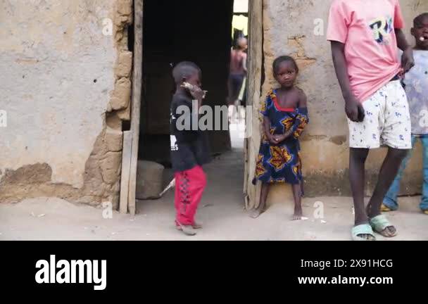 19 jan. 2024,Gwalada,Nigeria: Malnourished child due to extreme poverty, hunger, Rural Black ...