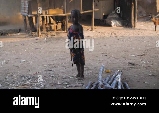 19 jan. 2024,Gwalada,Nigeria: Malnourished child due to extreme poverty, hunger, Rural Black ...