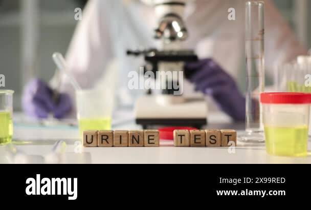 Scientist analyzes urinalysis using microscope in laboratory. Clinical ...