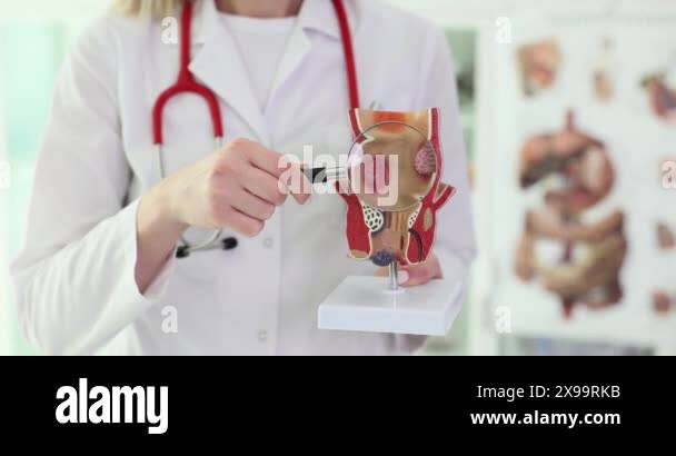 Proctologist is holding magnifying glass and anatomical model of rectum ...