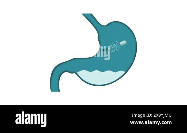 Stomach Intestine is Being Treated With Medicine Pill, Capsule with ...