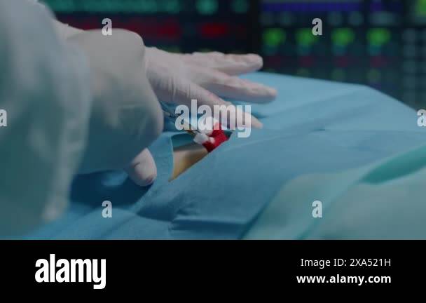 Closeup of unrecognizable surgeon using cotton swab to absorb blood in ...