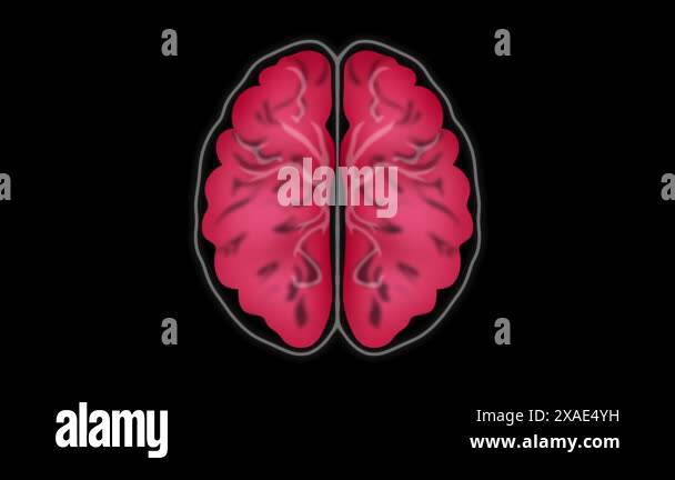 Animation of MRI scan of the brain, Magnetic resonance imaging of the ...