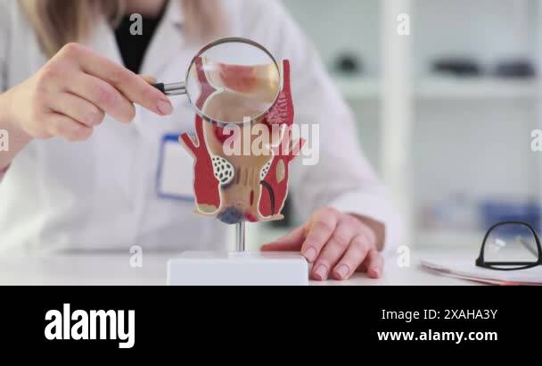 Anatomy of the rectum and a magnifying glass in hands of doctor ...