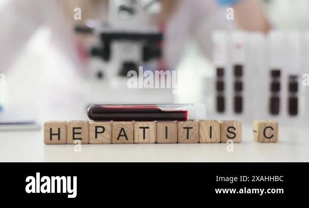 Hepatitis C and a test tube with blood in laboratory. Viral liver ...