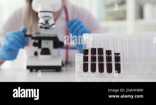 Diagnosis of blood diseases in laboratory. Microscopic analysis of ...