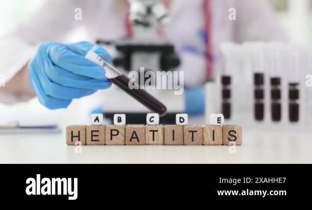 Hepatitis A B C D E and inflammatory liver diseases. Hepatitis causes ...