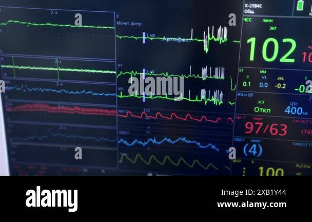Working monitor with running lines of life signs. Screen of a lung ...