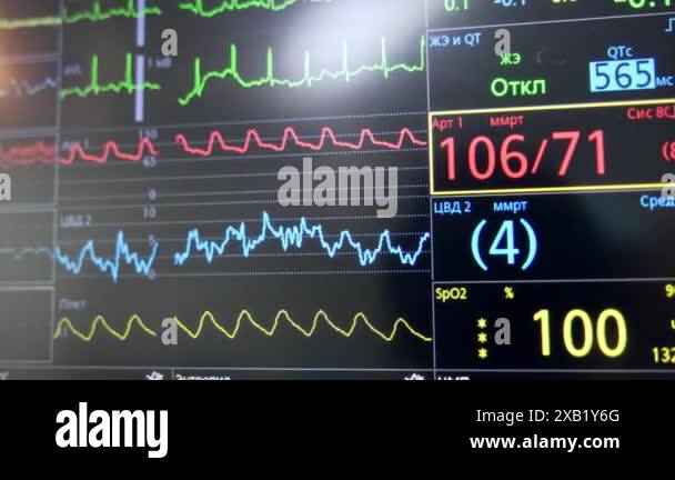 Diverse color curve lines of heart rate, oxygen levels and parameters ...