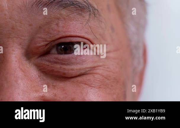 Mature cataract Stock Videos & Footage - HD and 4K Video Clips - Alamy
