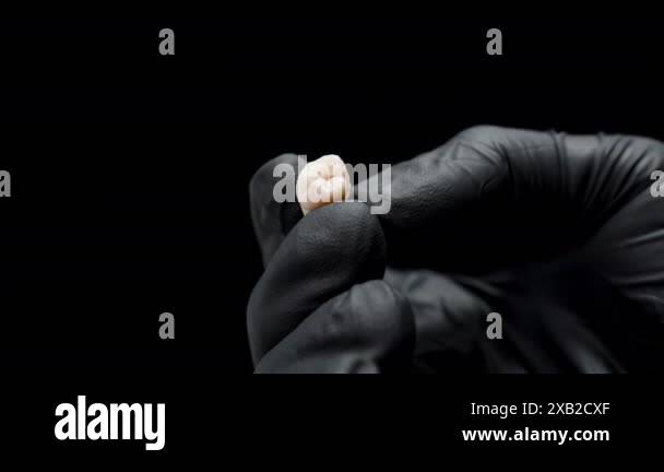 Human wisdom tooth Stock Videos & Footage - HD and 4K Video Clips - Alamy