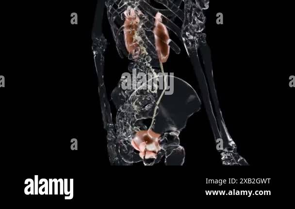 urinary system, detailed male bladder and Kidney anatomy, Urology ...