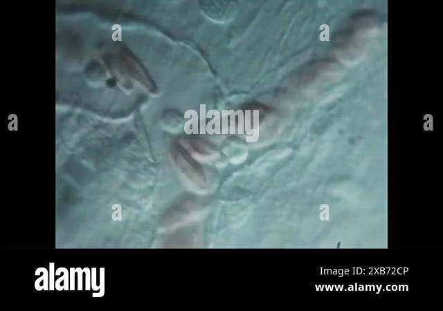USA - 1988 - An amoeba's plasma membrane is detected under an electron ...