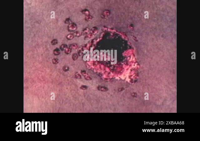 Shotgun wounds are explained; a doctor test fires a shotgun in the ...