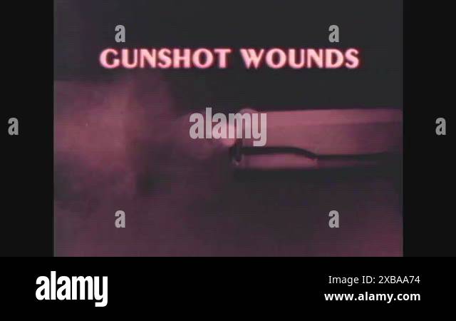 A gunshot wound is examined on a dead body at the morgue in the 1960s ...