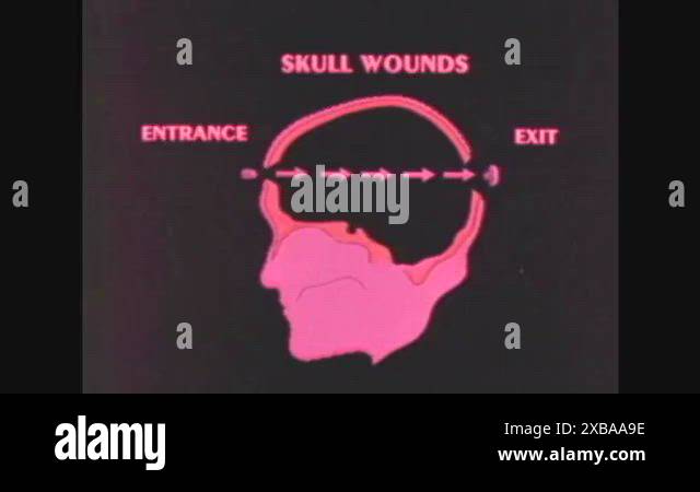 Entrance and exit wounds are examined on bodies and skulls at the ...