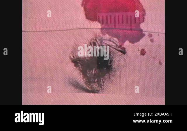 Microscopic examinations show what the bullet entrance wounds look like ...