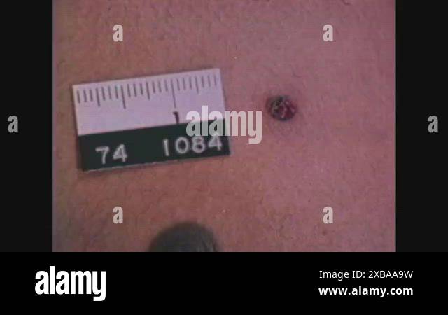 A doctor test fires a pistol in an attempt to determine the distance of ...