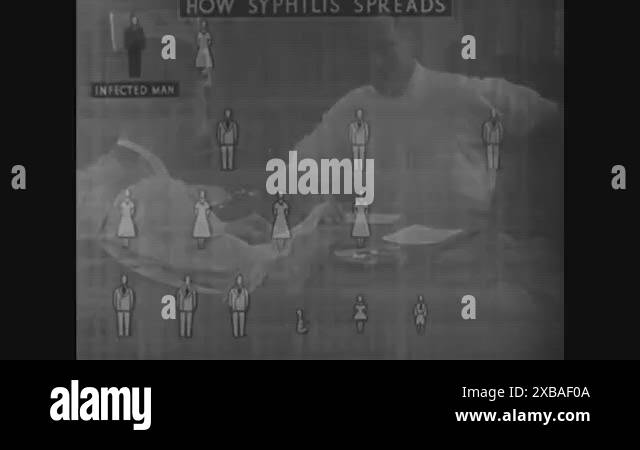 An animated chart shows the spread of the disease of syphilis, in 1939 ...
