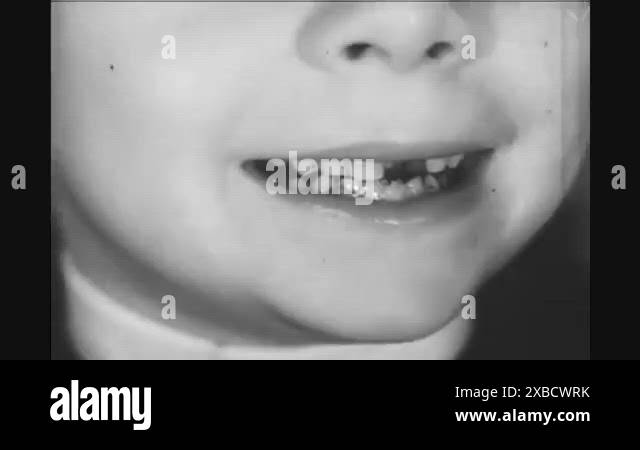 1955 - Animation is used to show how baby teeth are pushed out and ...