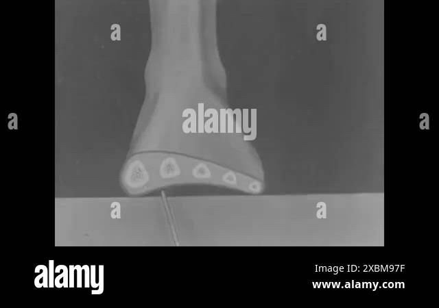 1935 - A podiatrist explains the bones, tendon muscles, and ligaments ...