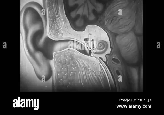 The external ear, pinna, auditory canal, middle ear, eardrum, ossicles ...