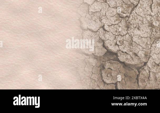 Skin Moisture Balance Dry Dehydrated Human Skin Before And After