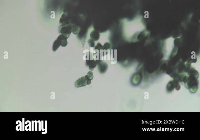 Microscopic view of a dark clump of algae, changing locations in the ...