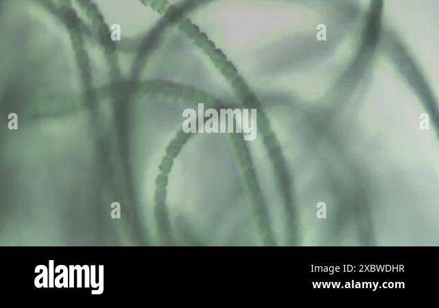 Nostoc species of cyano bacteria Stock Videos & Footage - HD and 4K ...