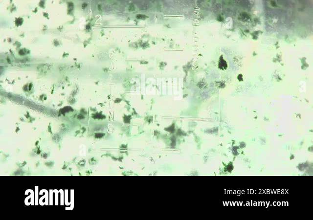 Green algae particles floating inside their nutrient medium. Algal ...