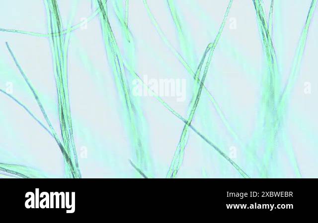 Microscopic view of algae ribbons or filaments which move their ...
