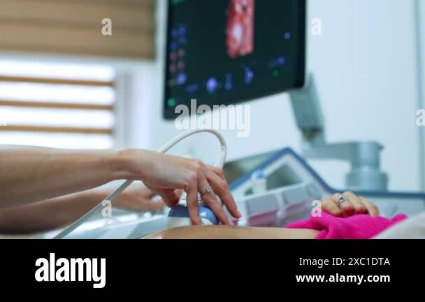 Ultrasonic check up for a Caucasain woman on early stage of pregnancy ...