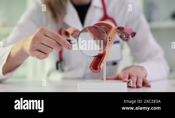 Gynecologist uses magnifying glass explaining features of reproductive ...