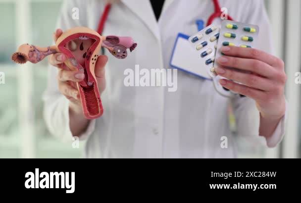 Gynecologist Holds Uterus Model And Pills In Clinic Woman Doctor Explains Benefits Of Oral