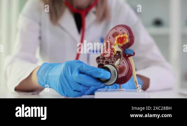 Nephrologist examines kidney model using stethoscope. Professional ...