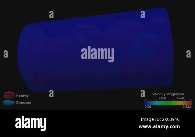 Blood vessel formation illustration Stock Videos & Footage - HD and 4K ...